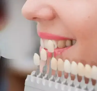 iDentalStudio - София | Актуална информация, работно време и контакти